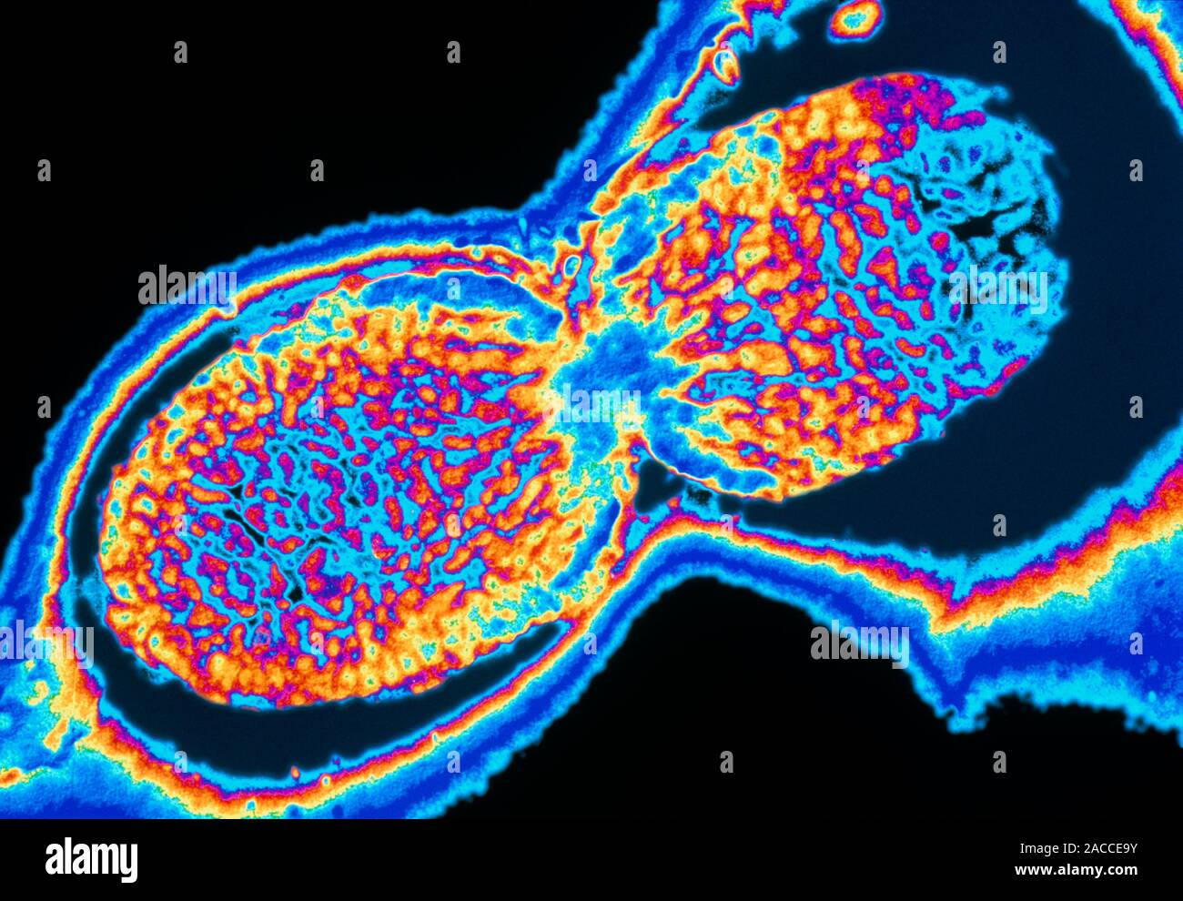 Shigella flexneri. Coloured transmission electron micrograph (TEM) of a ...