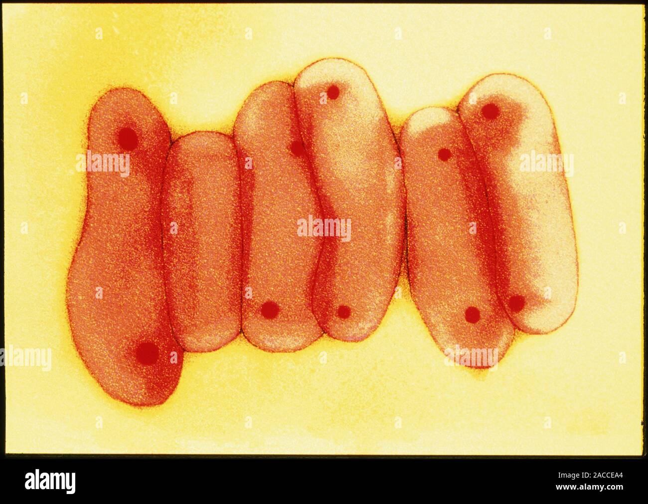 Mycobacterium tuberculosis. Coloured transmission electron micrograph ...