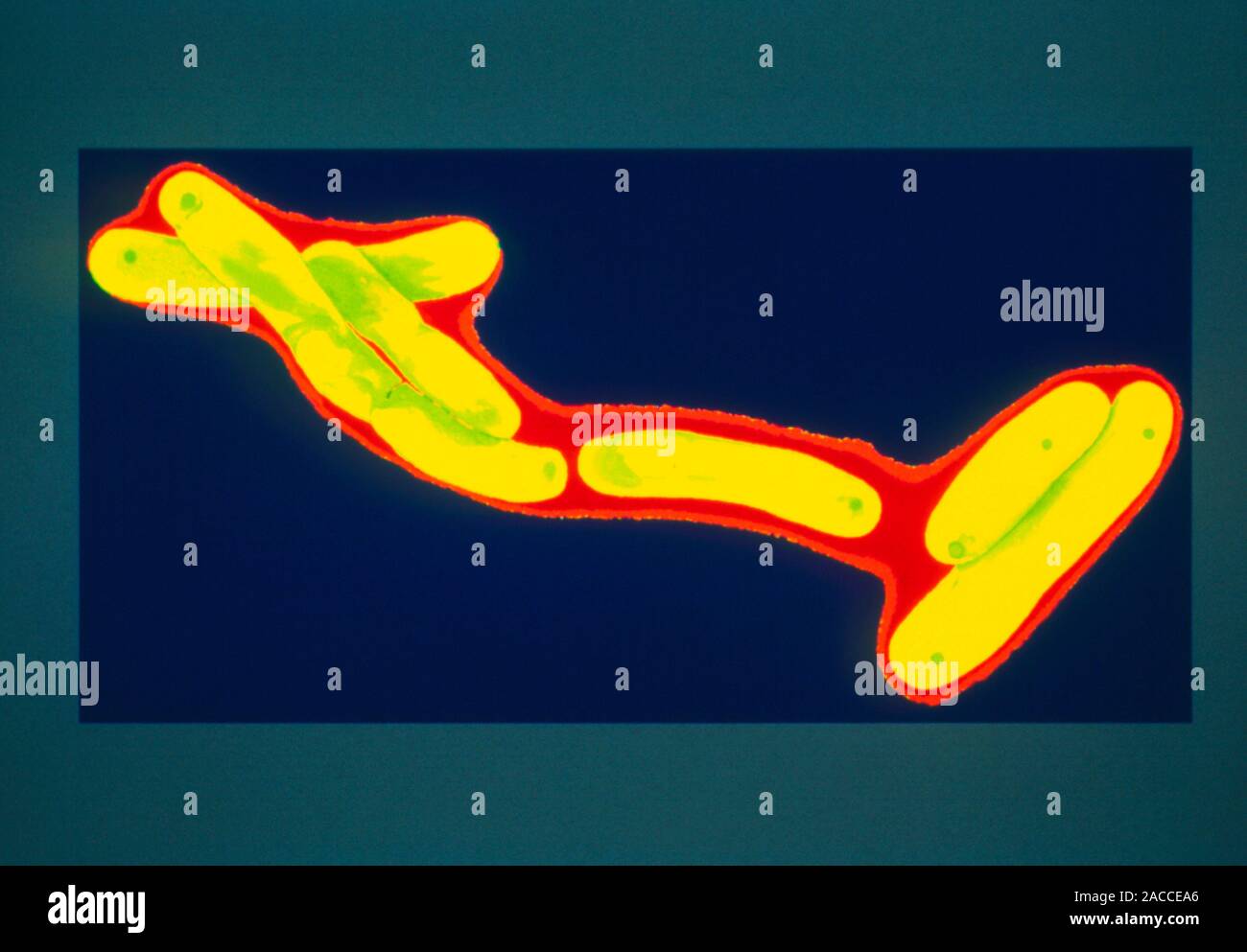 Mycobacterium tuberculosis. Coloured transmission electron micrograph ...