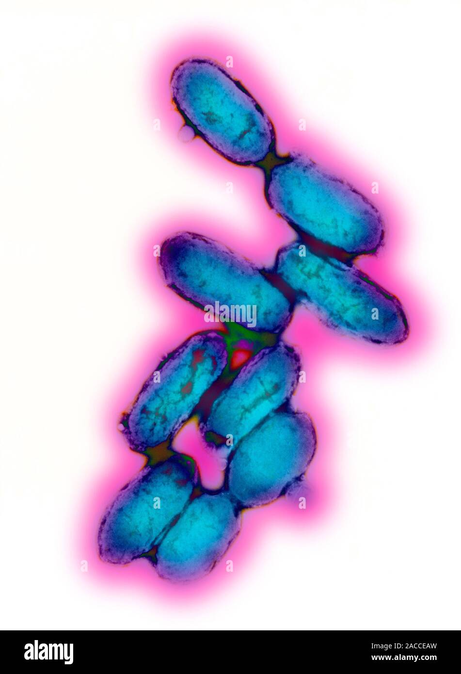 Yersinia pestis. Coloured transmission electron micrograph (TEM) of a ...