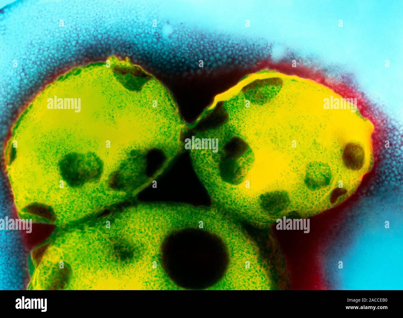 Sutterella bacteria. Coloured transmission electron micrograph (TEM) of ...
