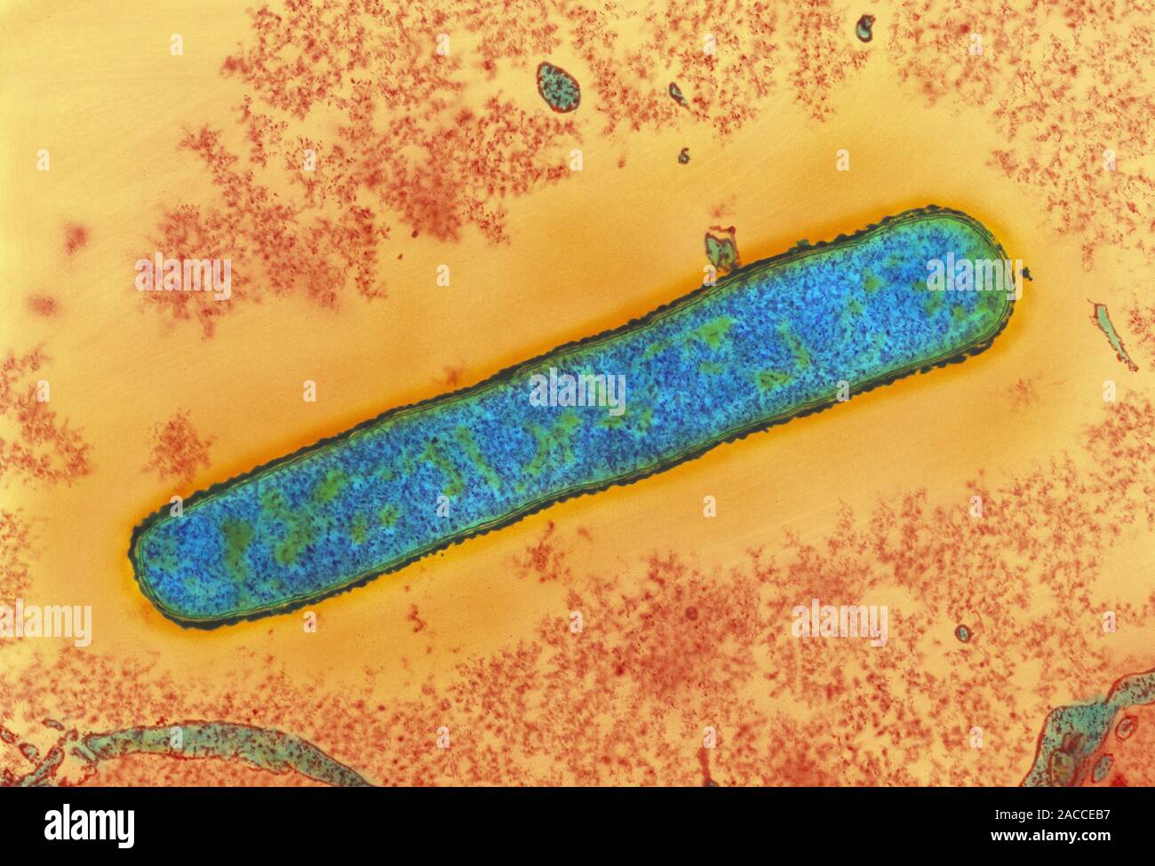 Anthrax bacterium. Coloured scanning electron micrograph (SEM) of an ...