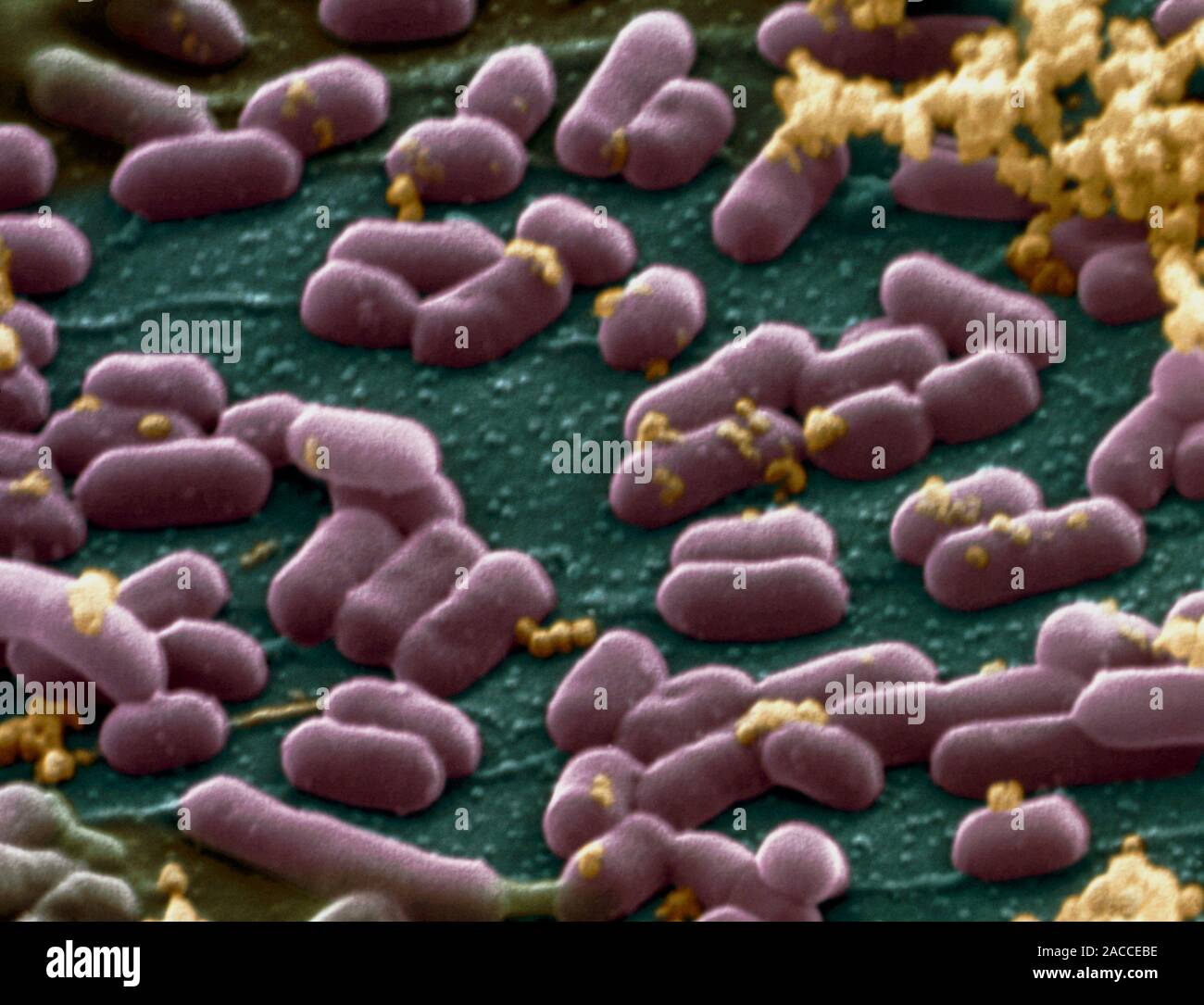 Listeria monocytogenes bacteria. Coloured scanning electron micrograph ...