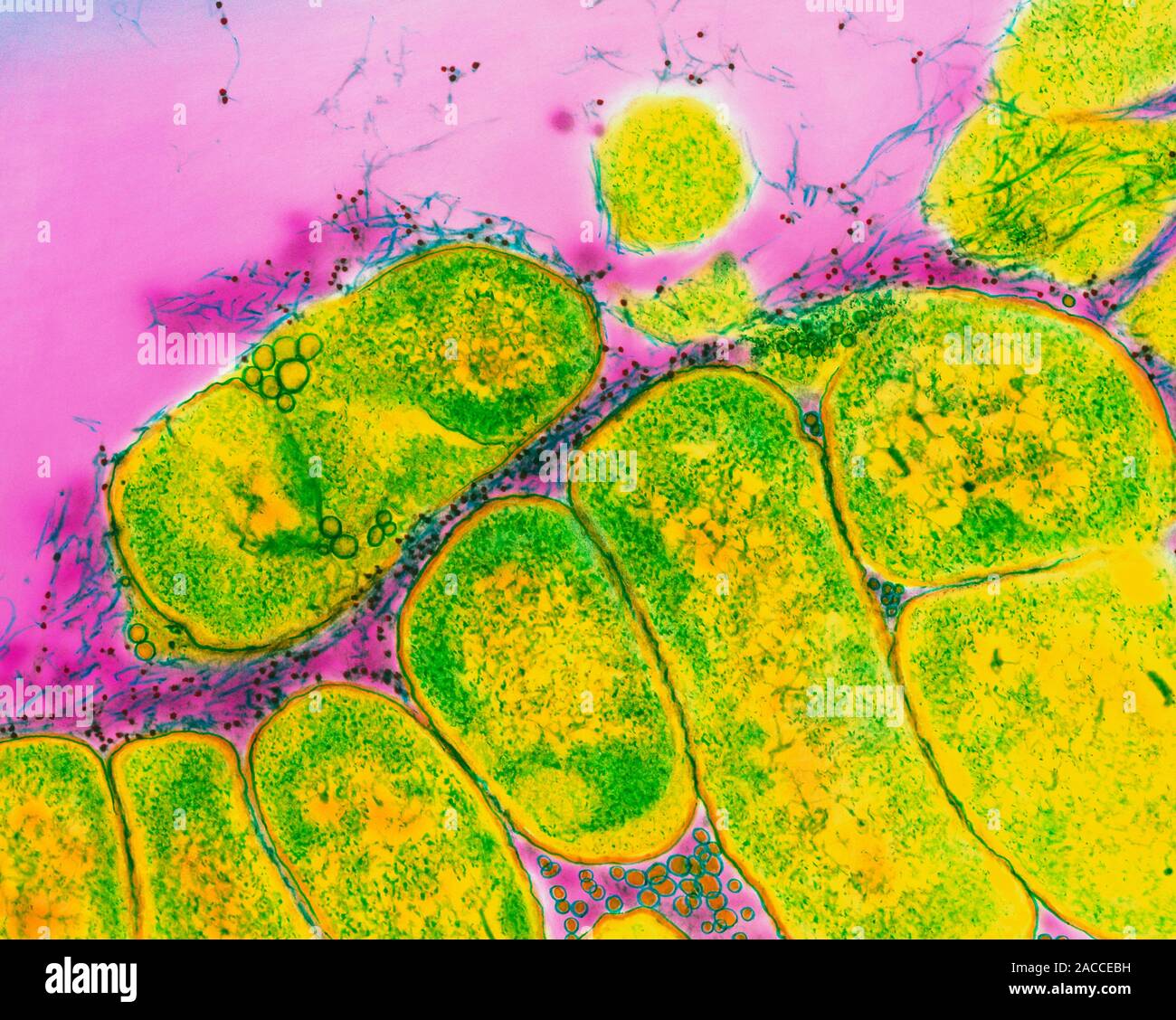 Actinobacillus bacteria. Coloured transmission electron micrograph (TEM ...