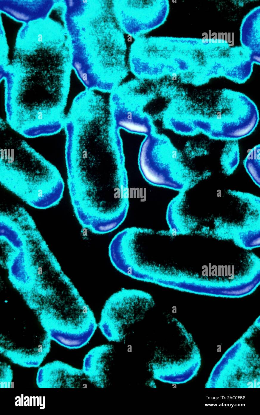 Pseudomonas aeruginosa bacteria. Coloured scanning electron micrograph ...