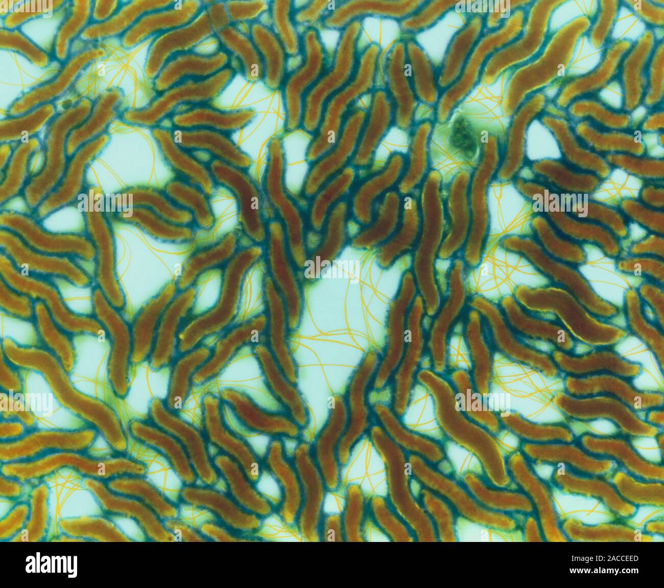 Campylobacter jejuni bacteria. Coloured transmission electron ...