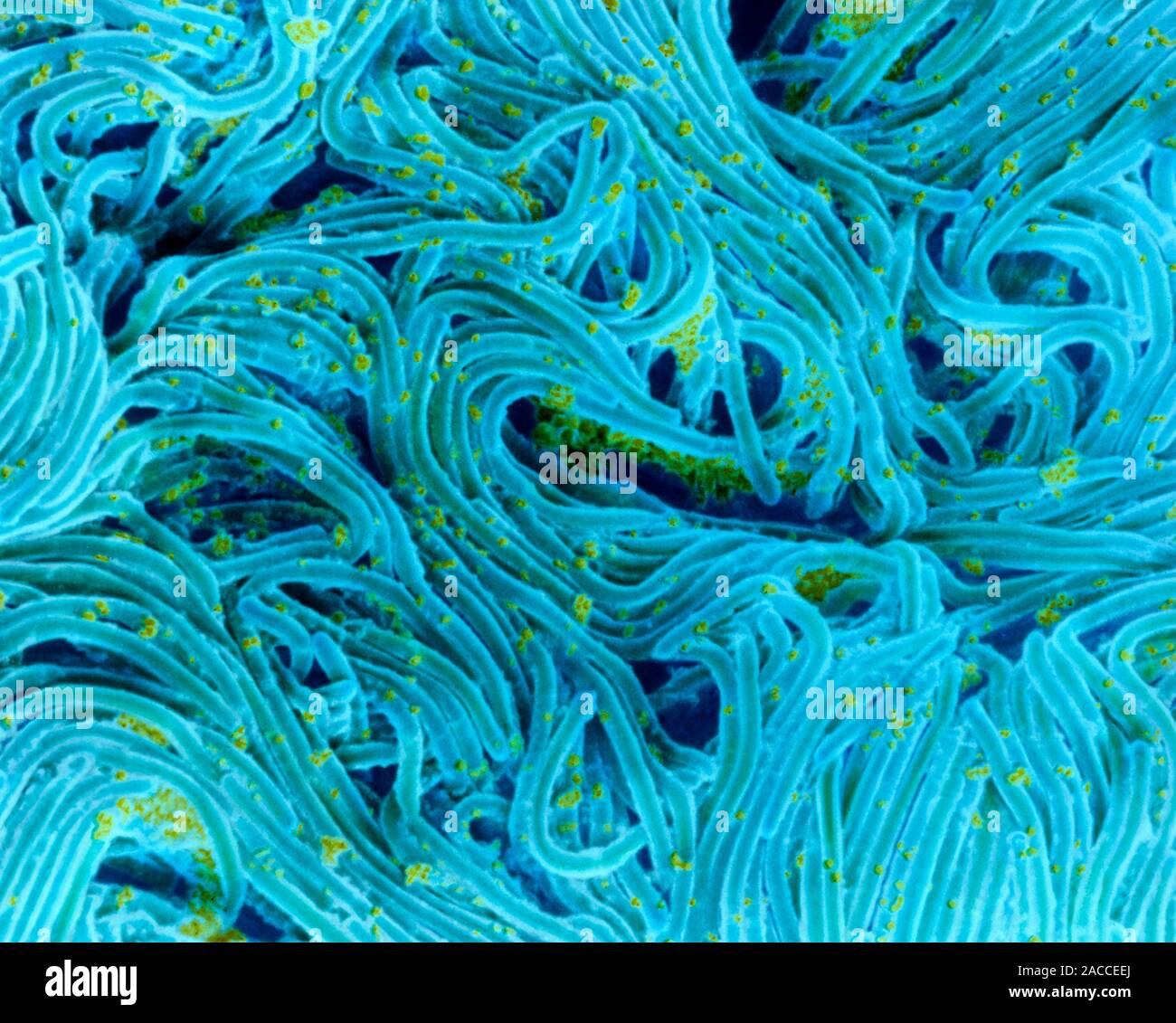 Filifactor villosus bacteria. Coloured scanning electron micrograph ...