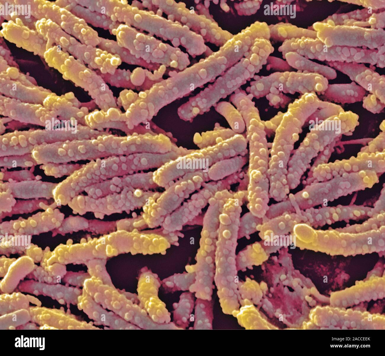 Bacteria. Coloured scanning electron micrograph (SEM) of unidentified ...