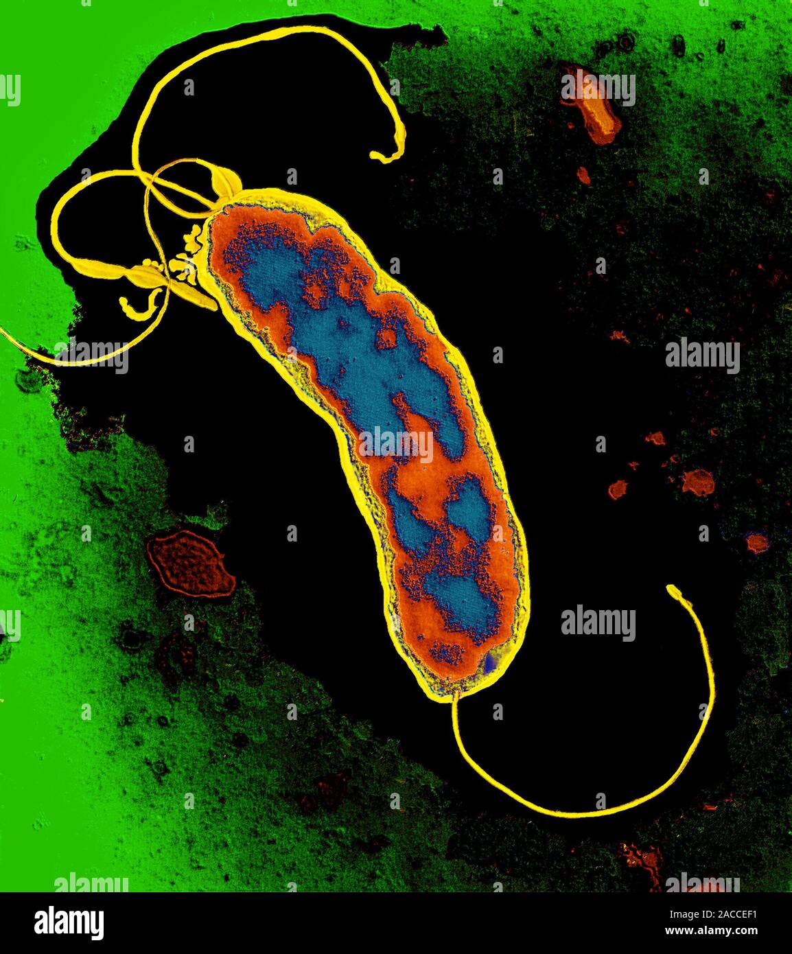 Helicobacter pylori bacterium. Coloured trans- mission electron ...