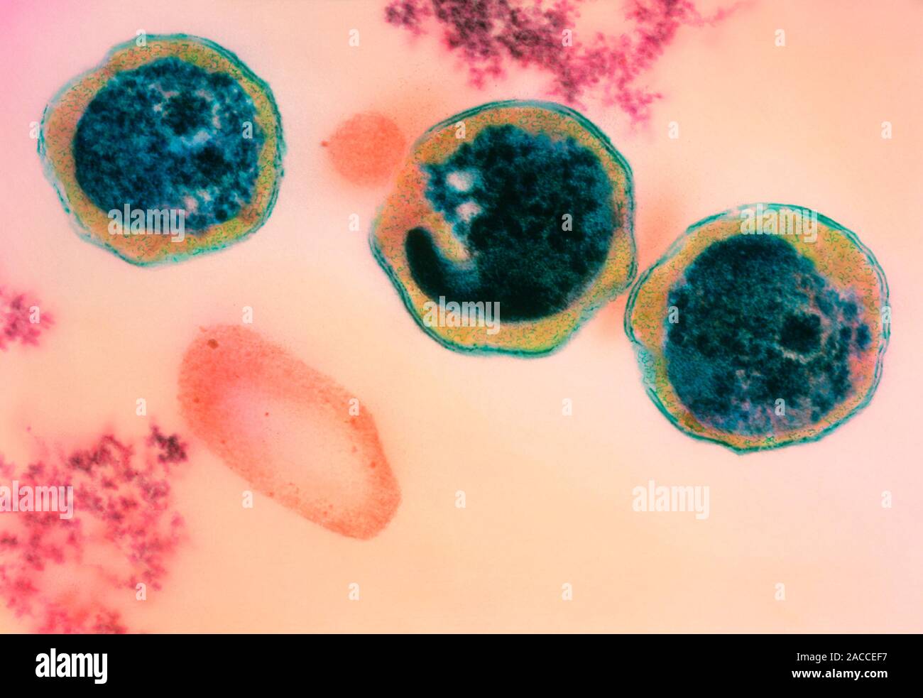 Chlamydia pneumoniae bacteria. Coloured transmission electron ...