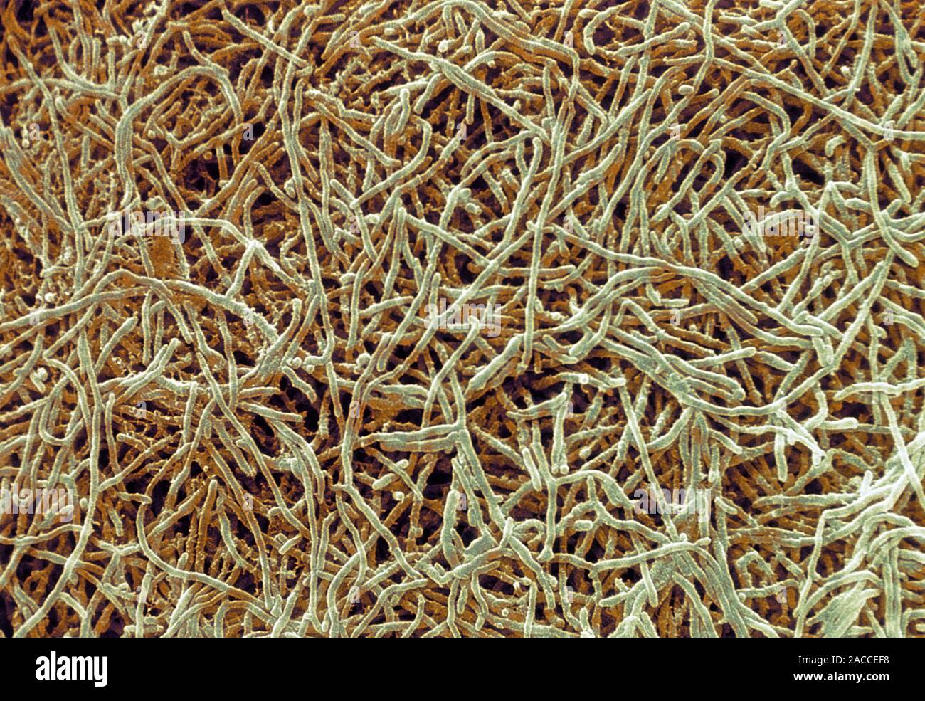 Actinomycete bacteria. Coloured scanning electron micrograph (SEM) of ...