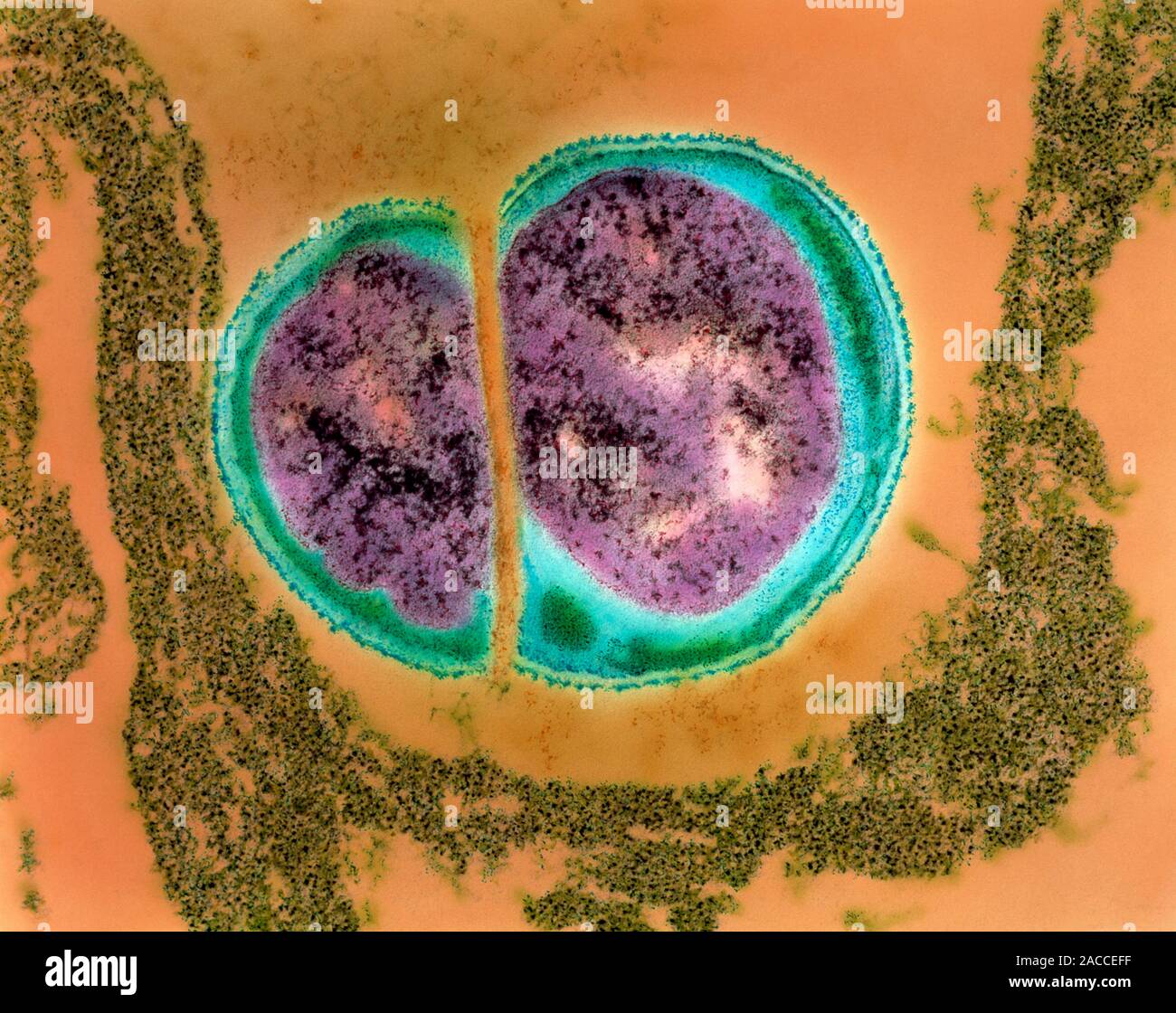 Alloiococcus bacterium. Coloured transmission electron micrograph (TEM ...