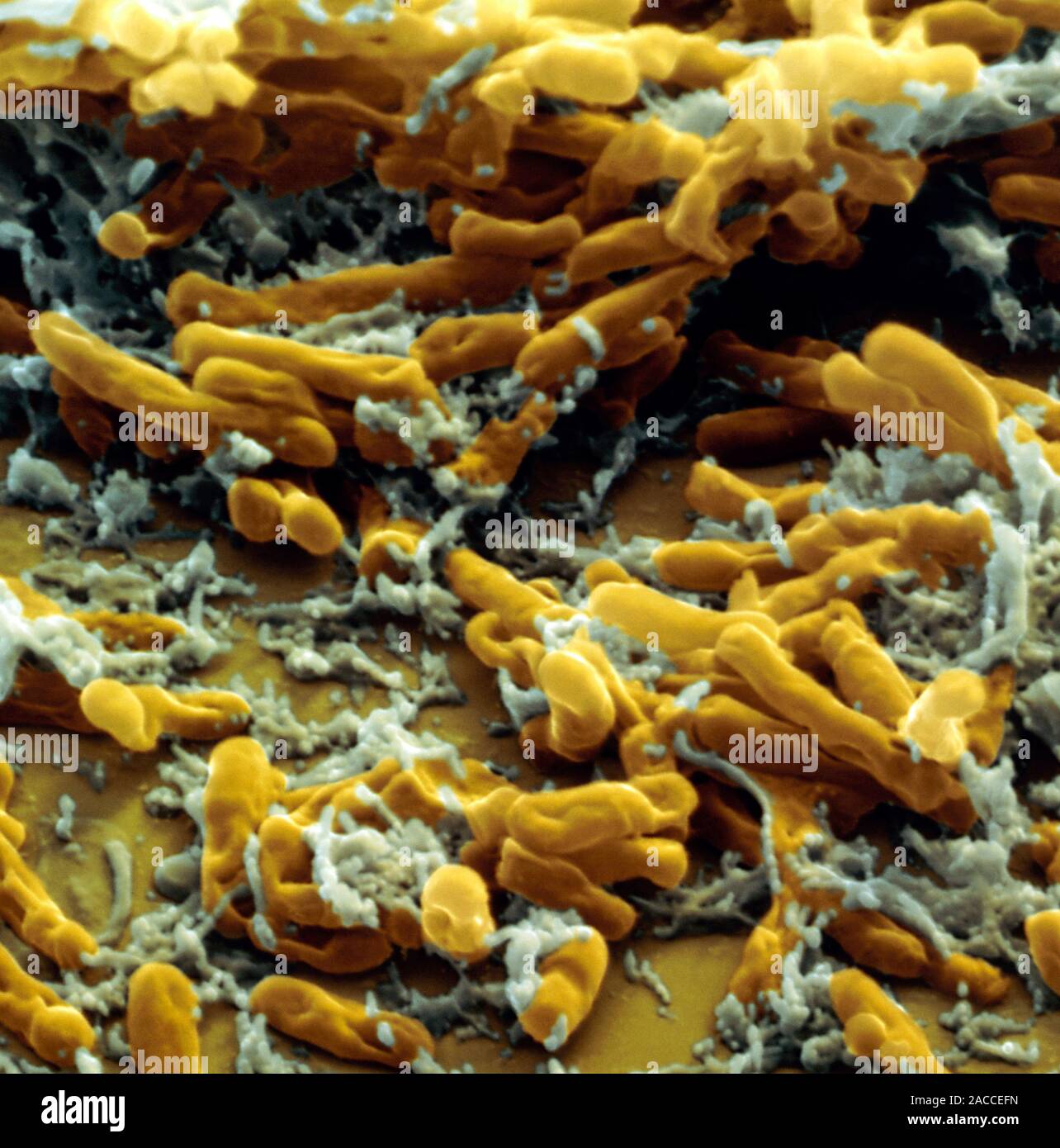 Tuberculosis bacteria. Coloured scanning electron micrograph (SEM) of a group of Mycobacterium ...