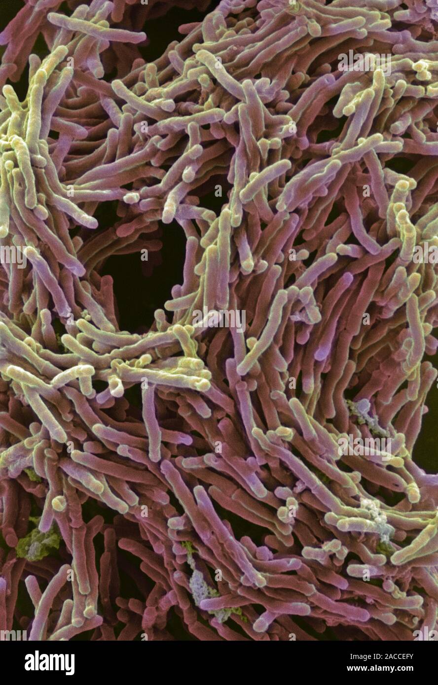 Tuberculosis bacteria. Coloured scanning electron micrograph (SEM) of ... Tuberculosis bacteria. Coloured scanning electron micrograph (SEM) of ...