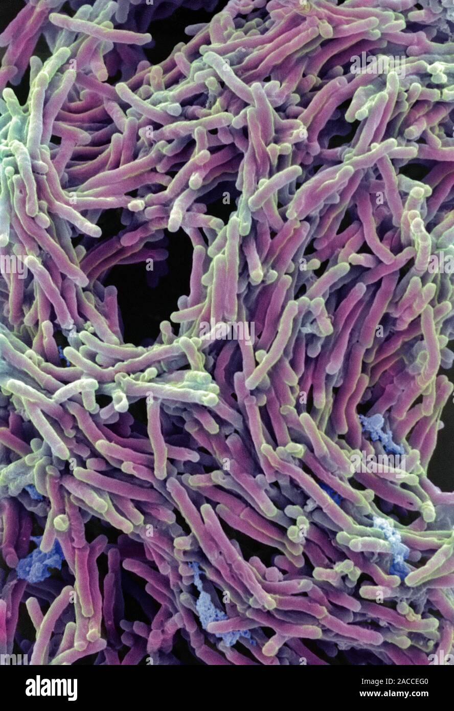 Tuberculosis bacteria. Coloured scanning electron micrograph (SEM) of Mycobacterium tuberculosis ...