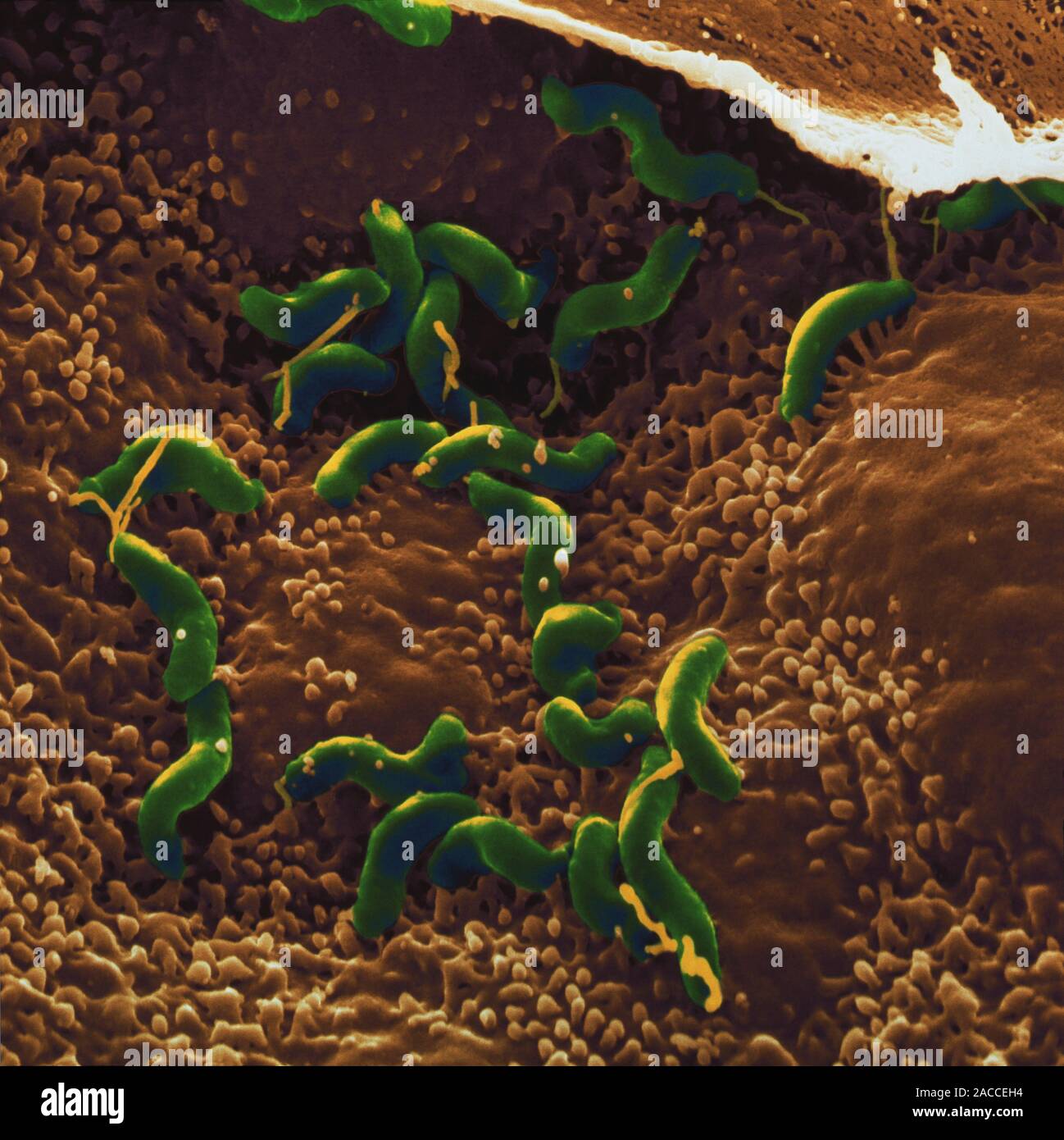 Helicobacter pylori bacteria. Coloured scanning electron micrograph ...