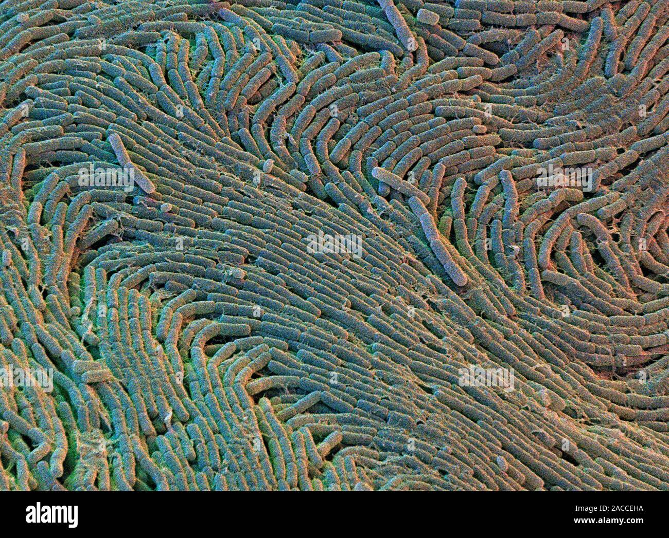 Bacillus cerus bacteria. Coloured scanning electron micrograph (SEM) of ...