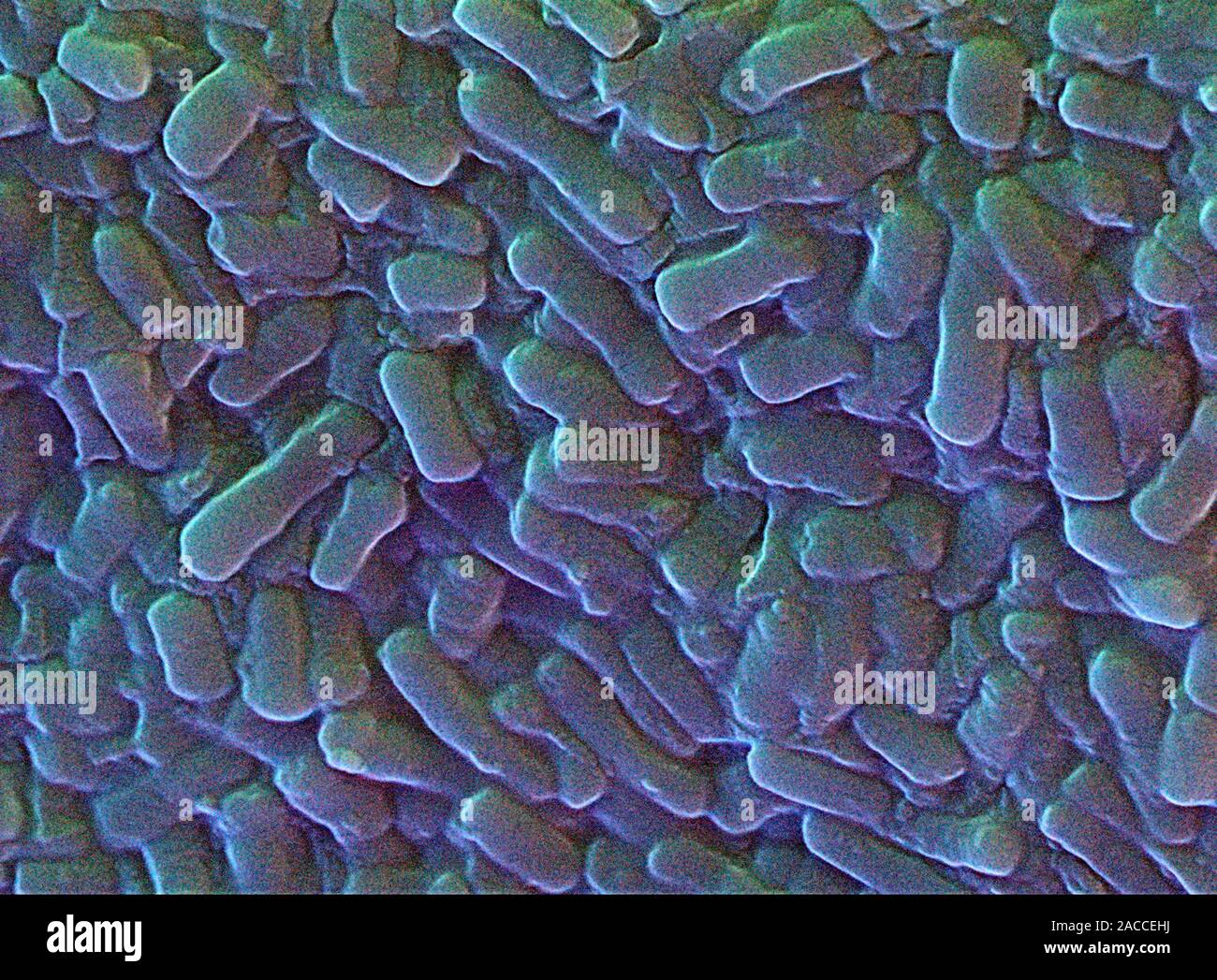 Clostridium perfringens bacteria. Coloured scanning electron micrograph ...