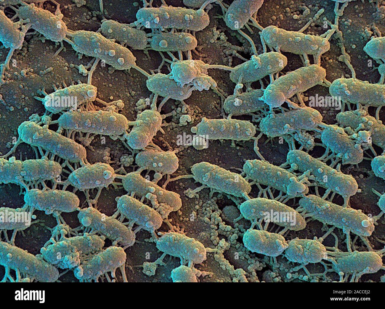 Food bacteria. Coloured scanning electron micrograph (SEM) of ...