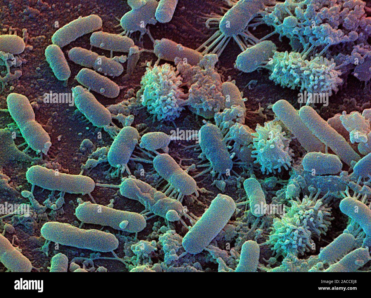 Kitchen bacteria. Coloured scanning electron micrograph (SEM) of ...