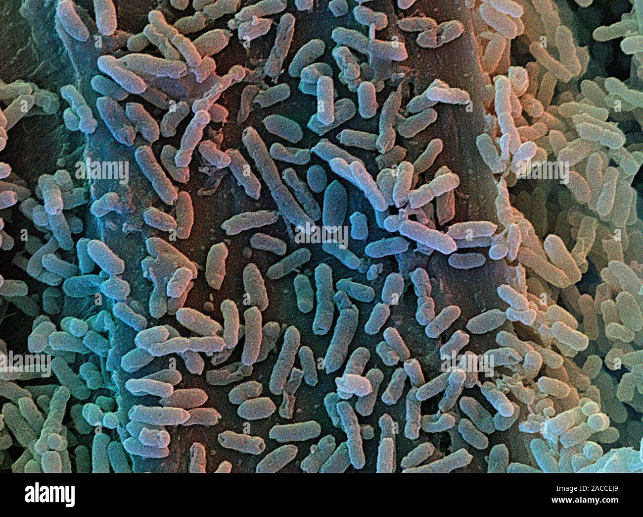 Kitchen bacteria. Coloured scanning electron micrograph (SEM) of ...