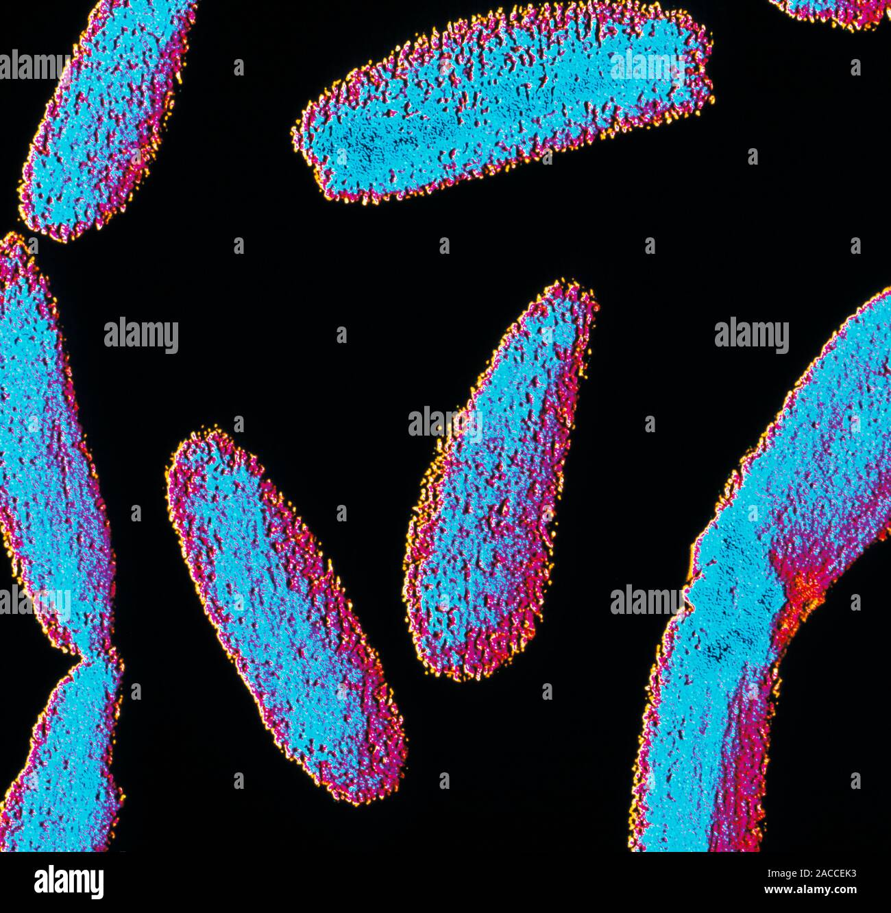 Anthrax bacteria. Coloured transmission electron micrograph (TEM) of sectioned Bacillus ...