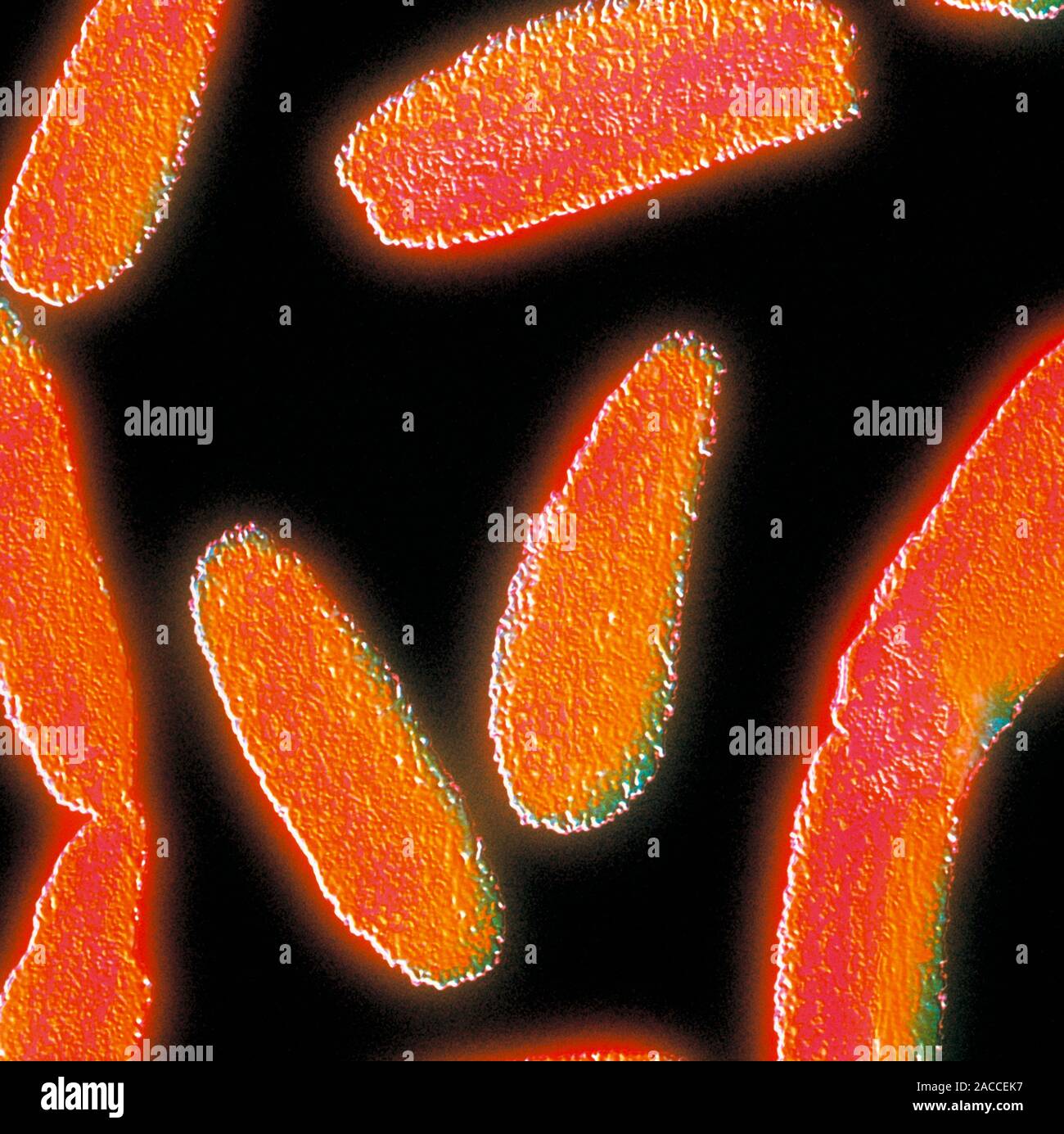 Anthrax bacteria. Coloured transmission electron micrograph (TEM) of ...