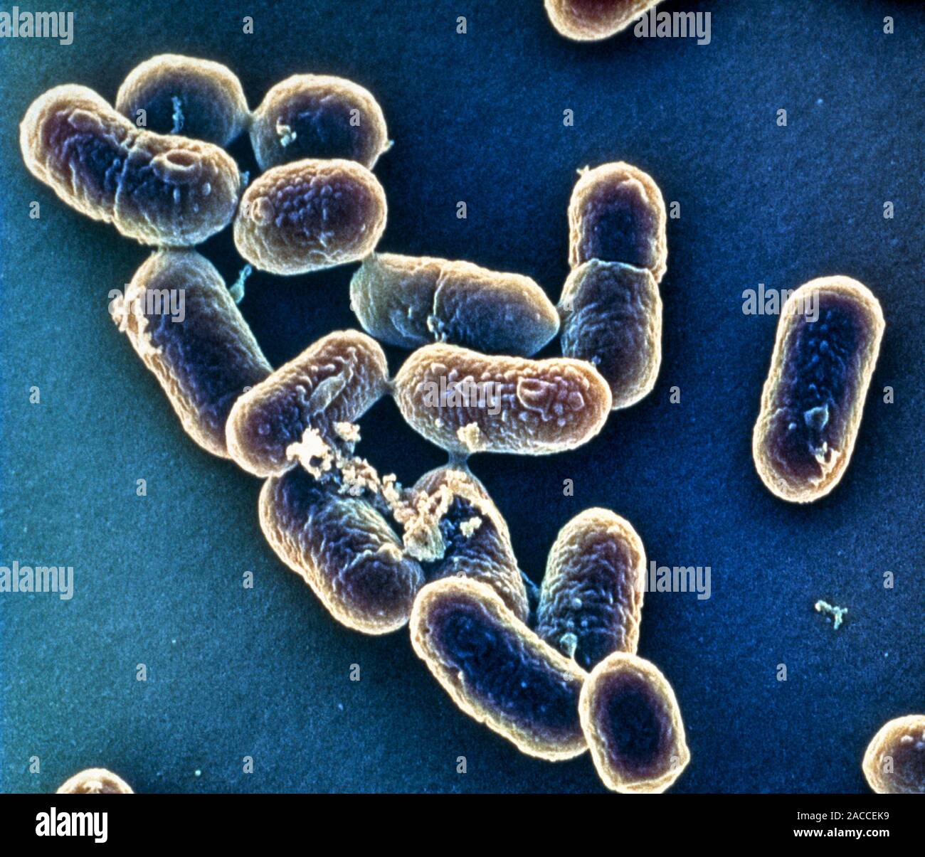 Listeria bacteria. Coloured scanning electron micrograph (SEM) of ...