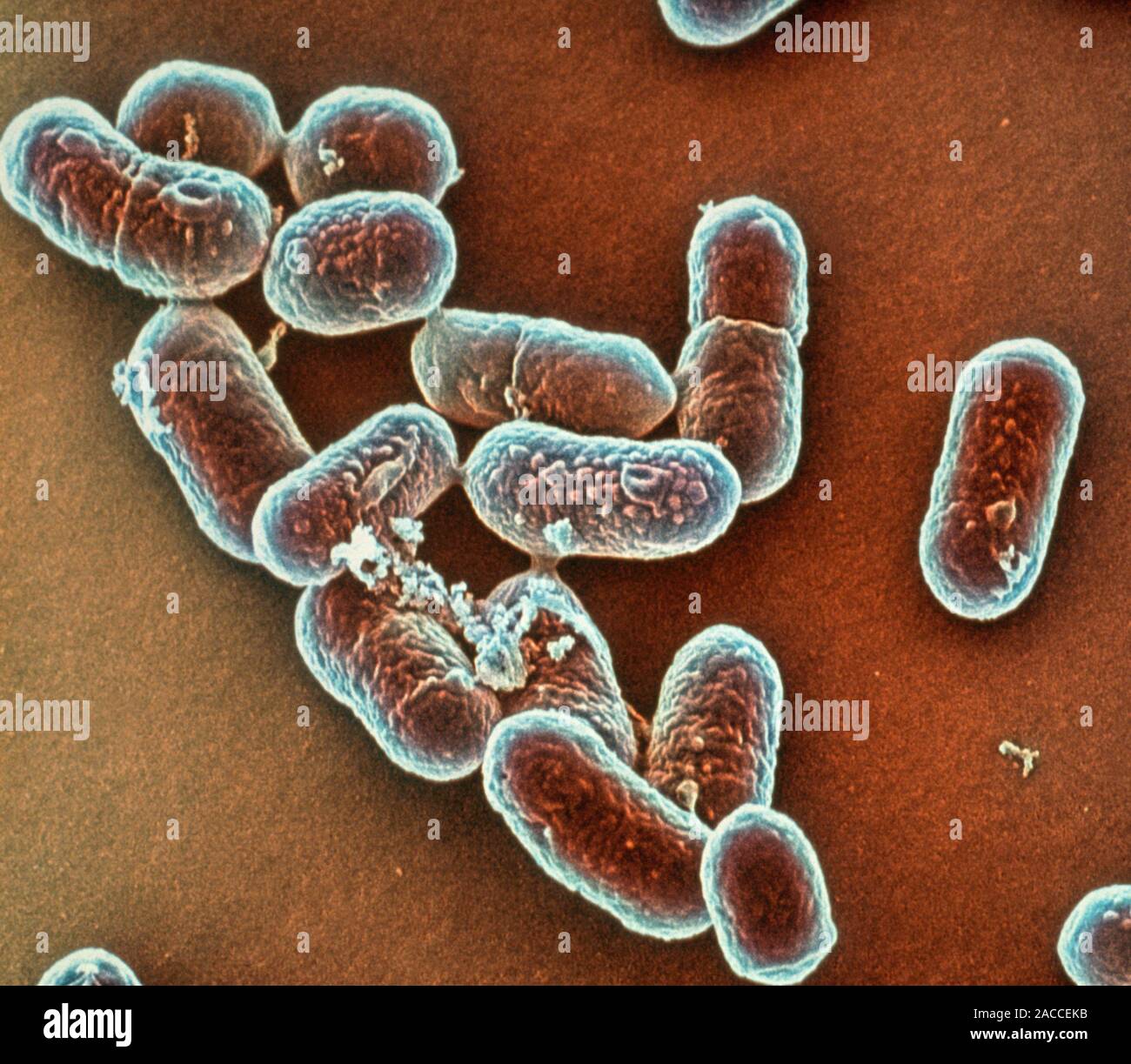 Listeria bacteria. Coloured scanning electron micrograph (SEM) of ...