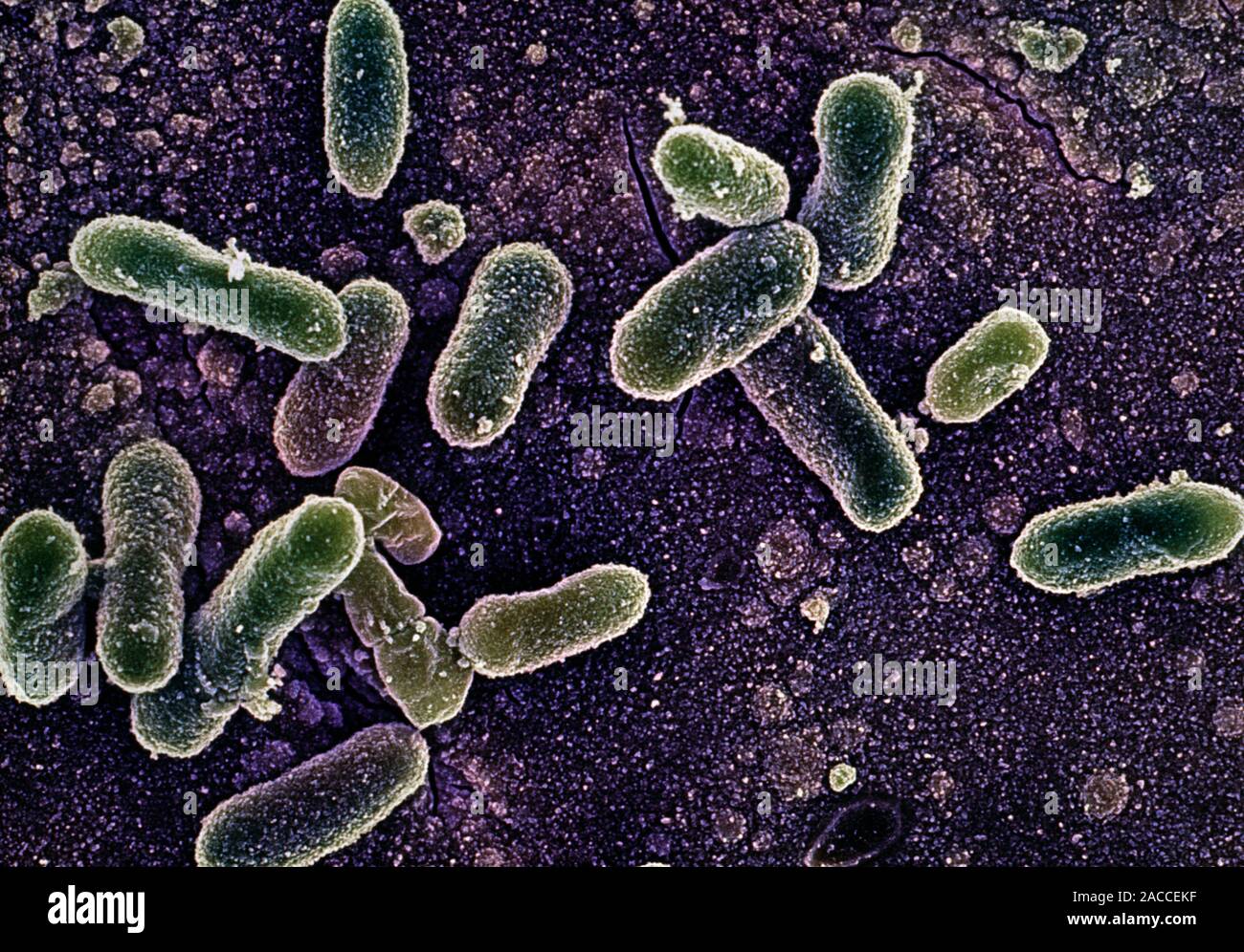 Salmonella enteritidis bacteria. Coloured scanning electron micrograph ...