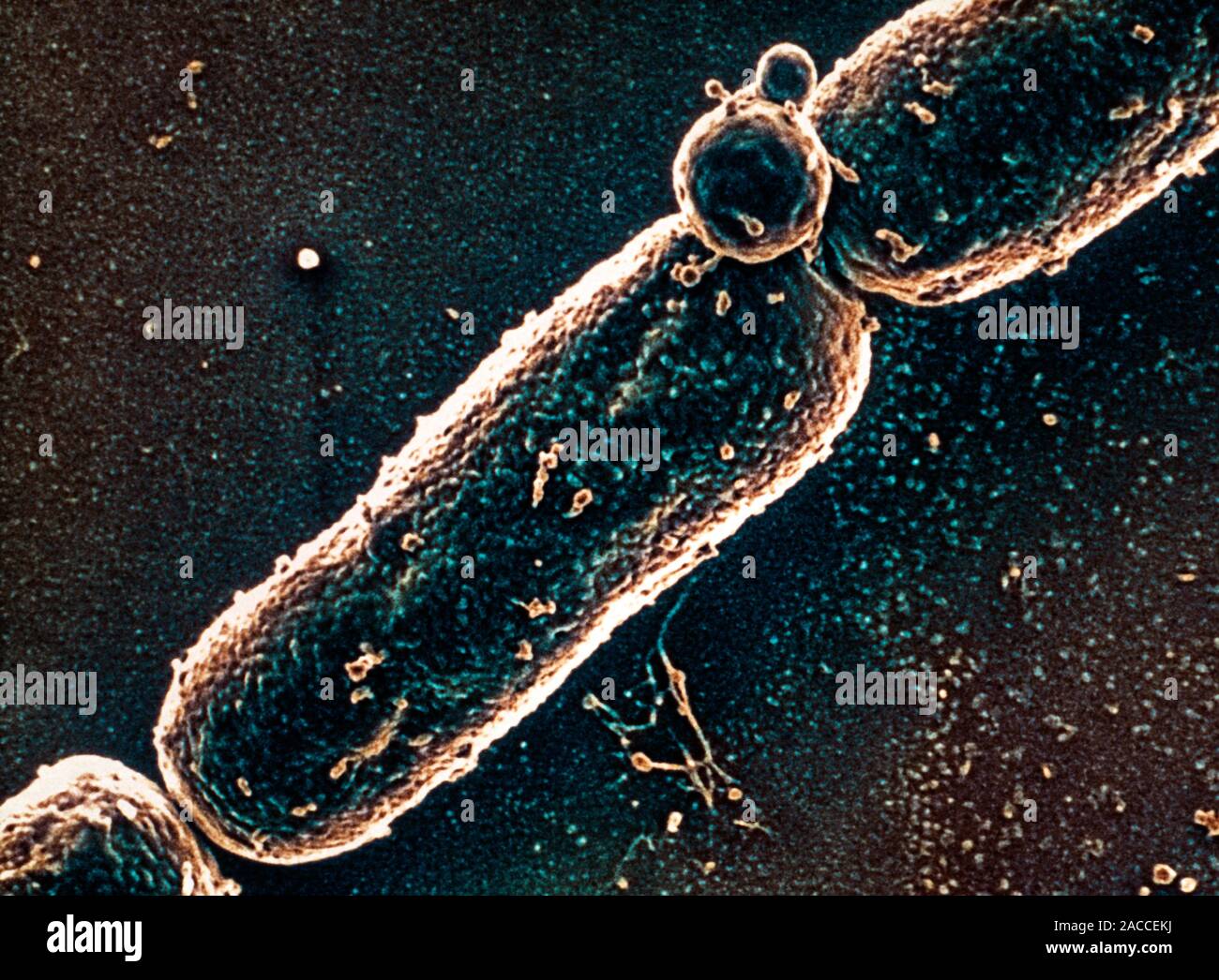 Anthrax bacteria. Coloured scanning electron micrograph (SEM) of ...