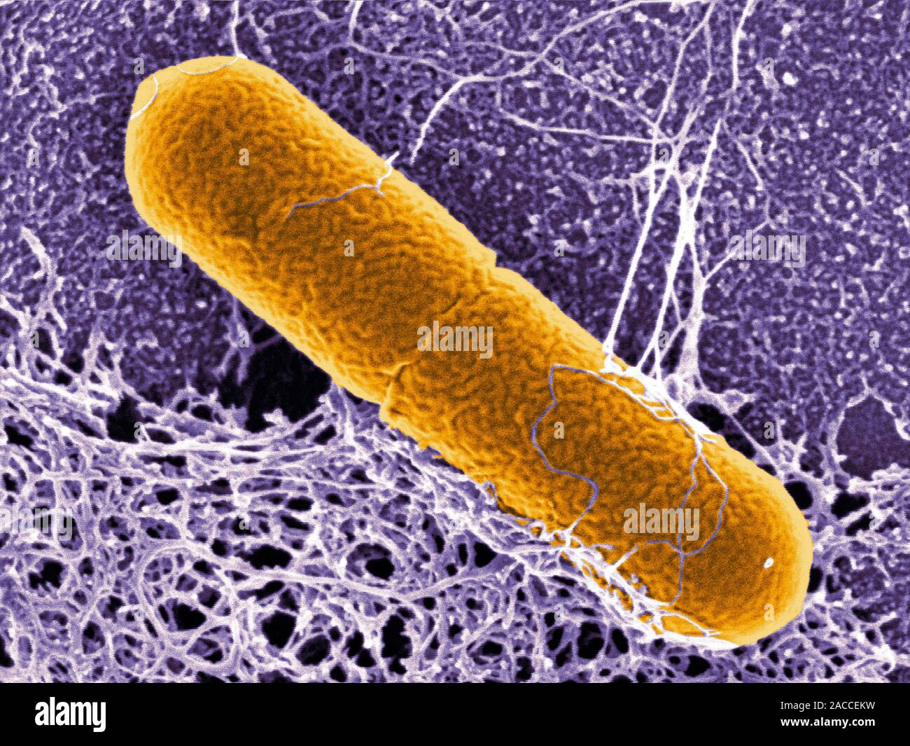Clostridium botulinum bacterium. Coloured scanning electron micrograph ...