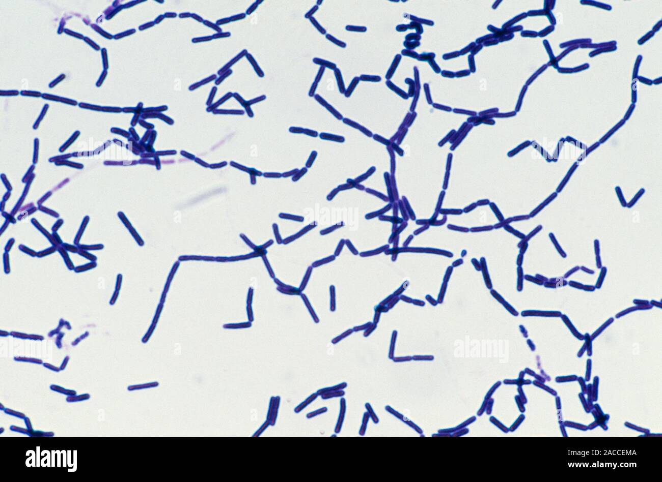 Anthrax bacteria. Light micrograph of anthrax bacteria (Bacillus ...