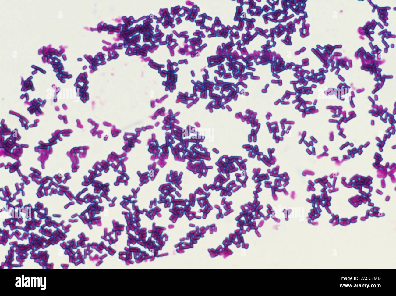 Gas gangrene bacteria. Light micrograph of gas gangrene bacteria ...