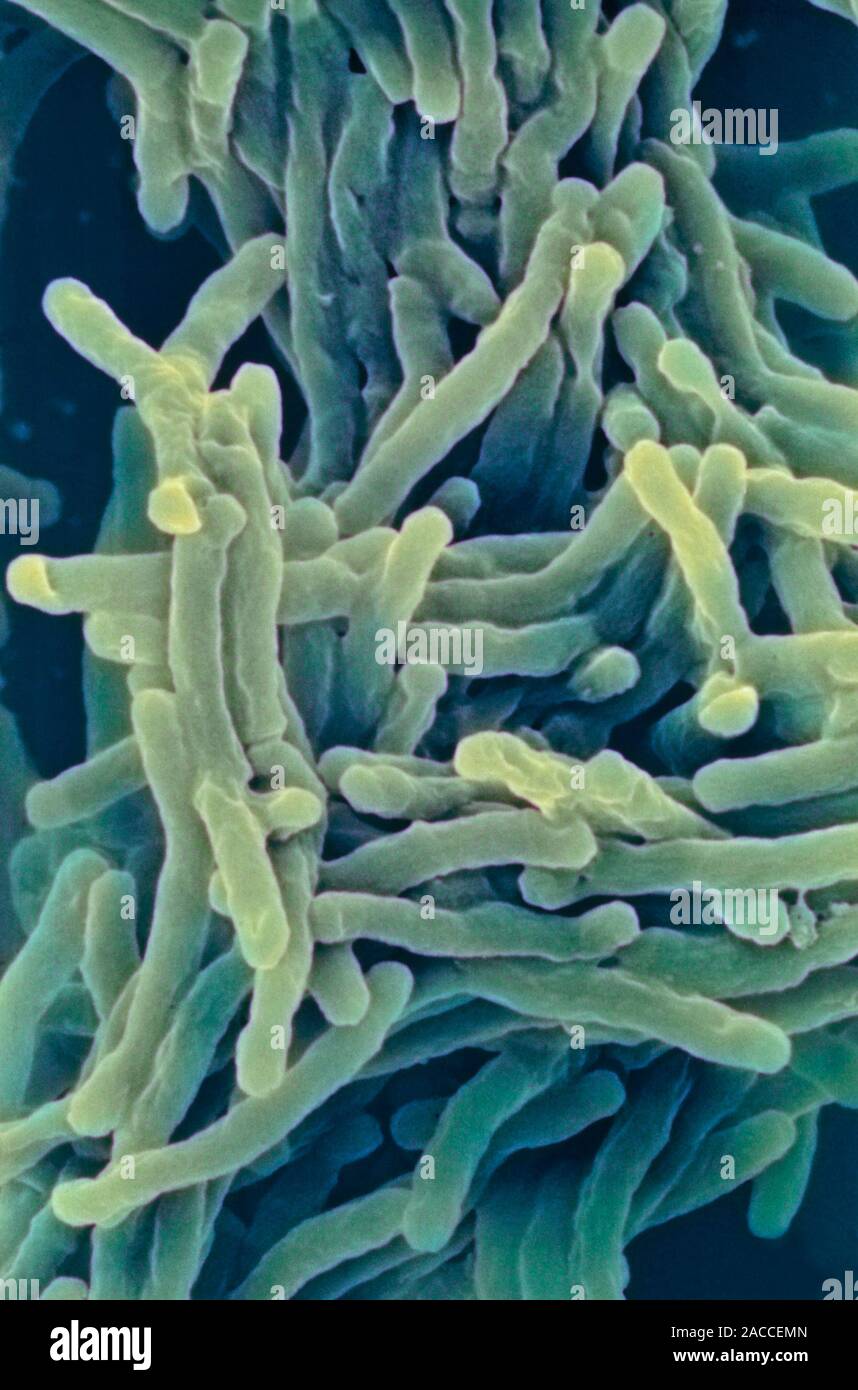 Tuberculosis bacteria. Coloured scanning electron micrograph (SEM) of Mycobacterium tuberculosis ...