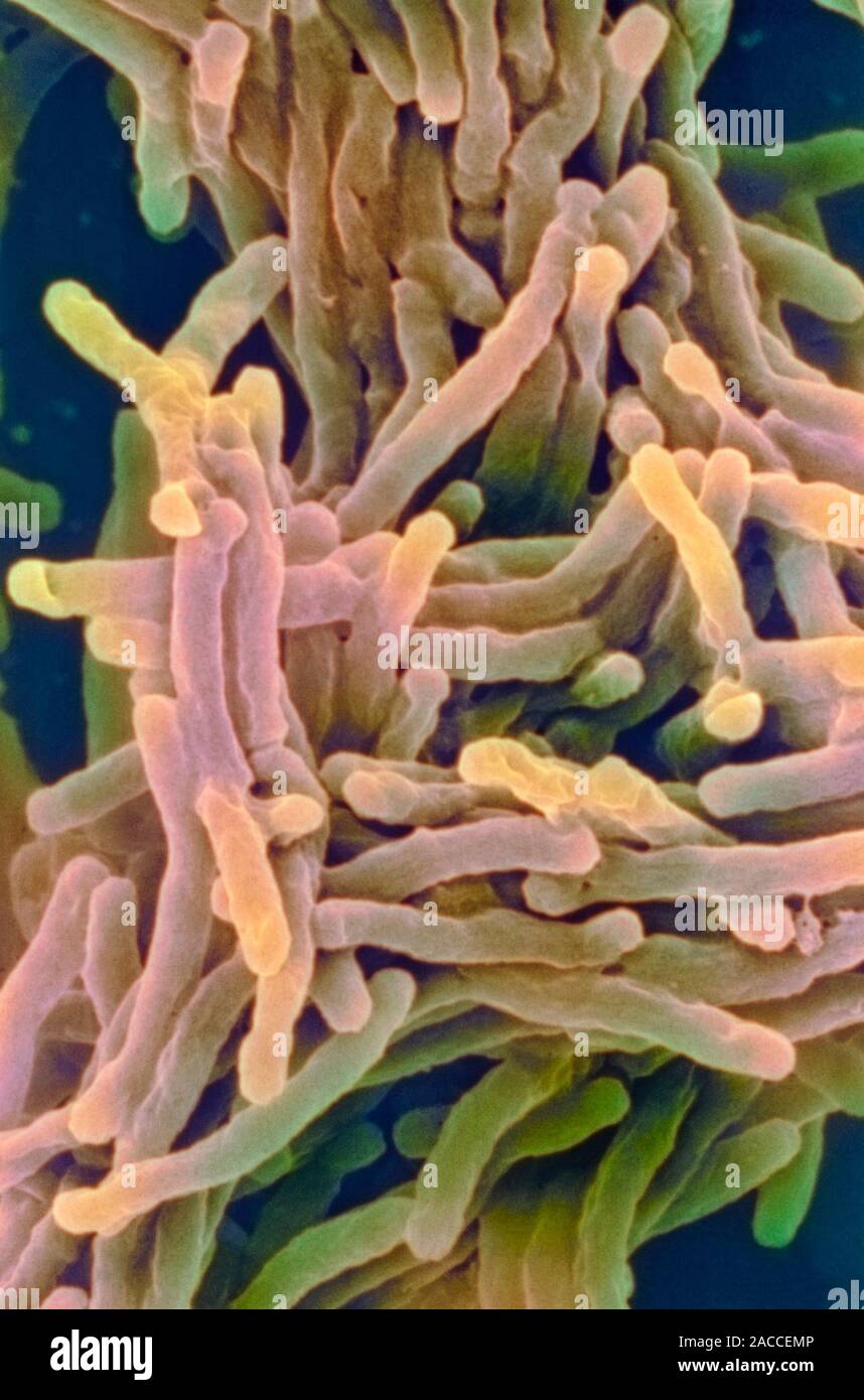 Tuberculosis bacteria. Coloured scanning electron micrograph (SEM) of Mycobacterium tuberculosis ...