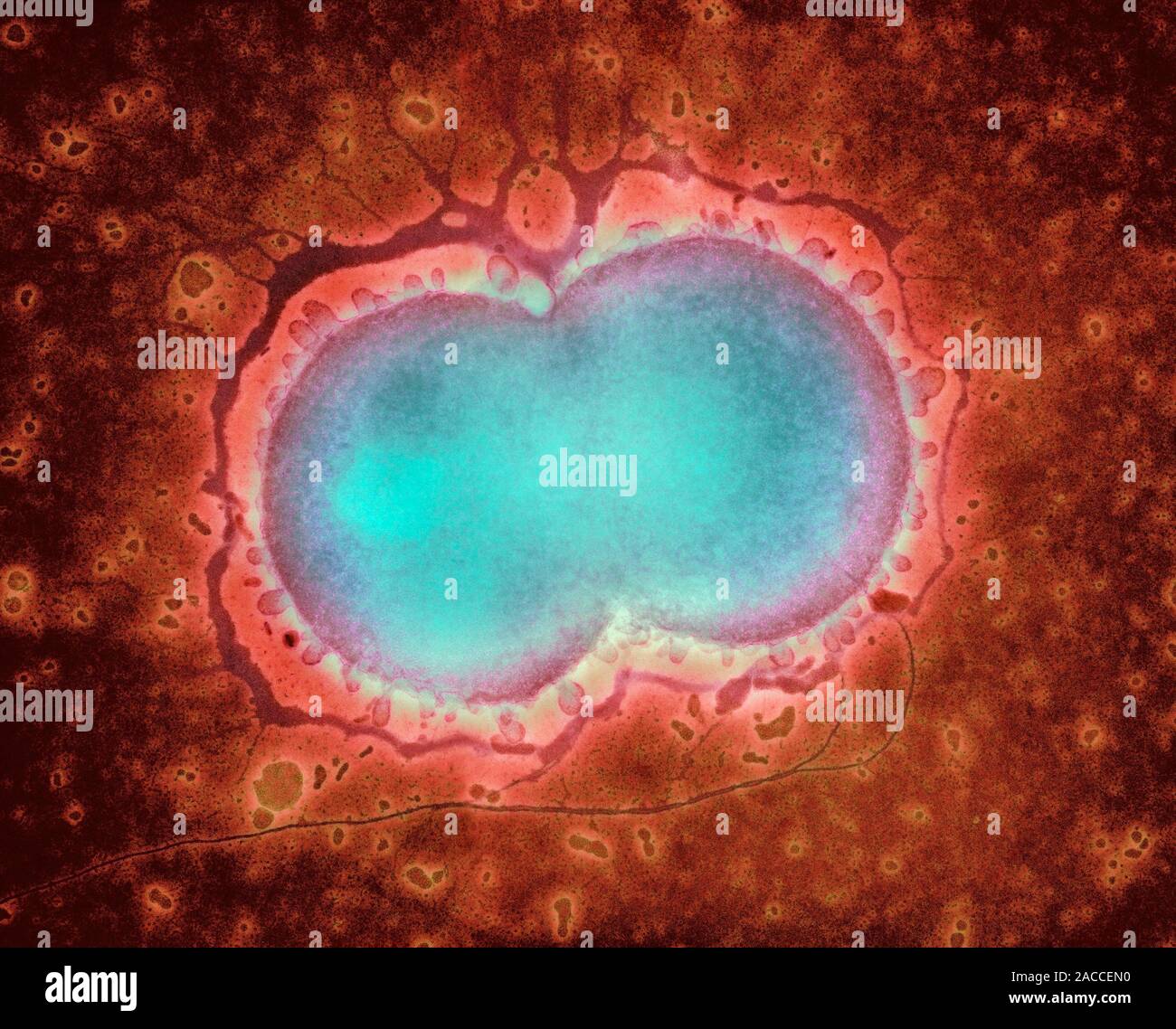 Neisseria bacterium dividing. Coloured transmission electron micrograph ...