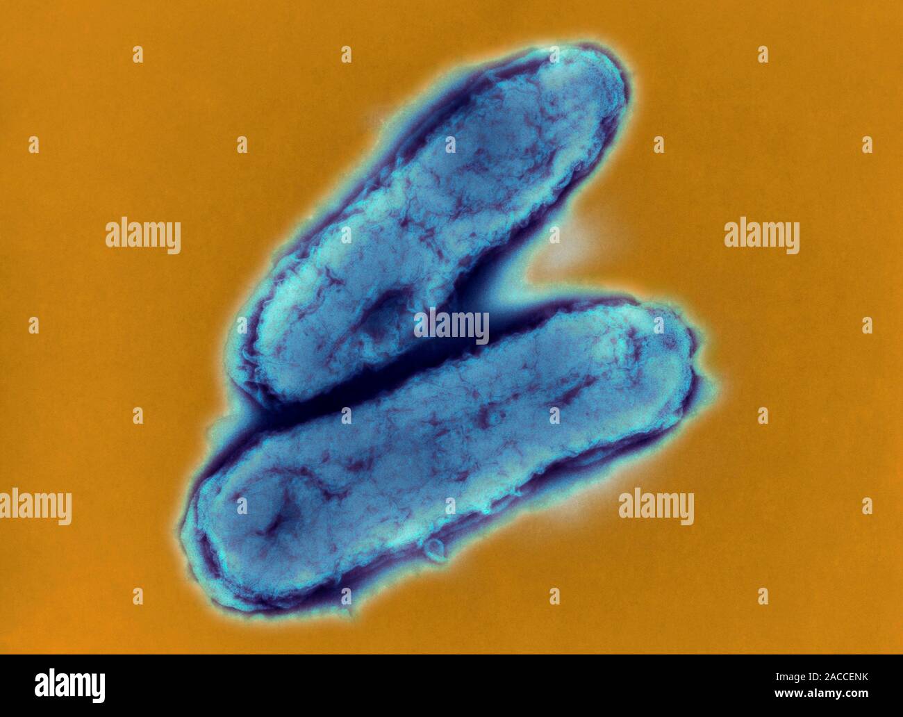 Haemophilus influenzae bacteria. Coloured transmission electron ...
