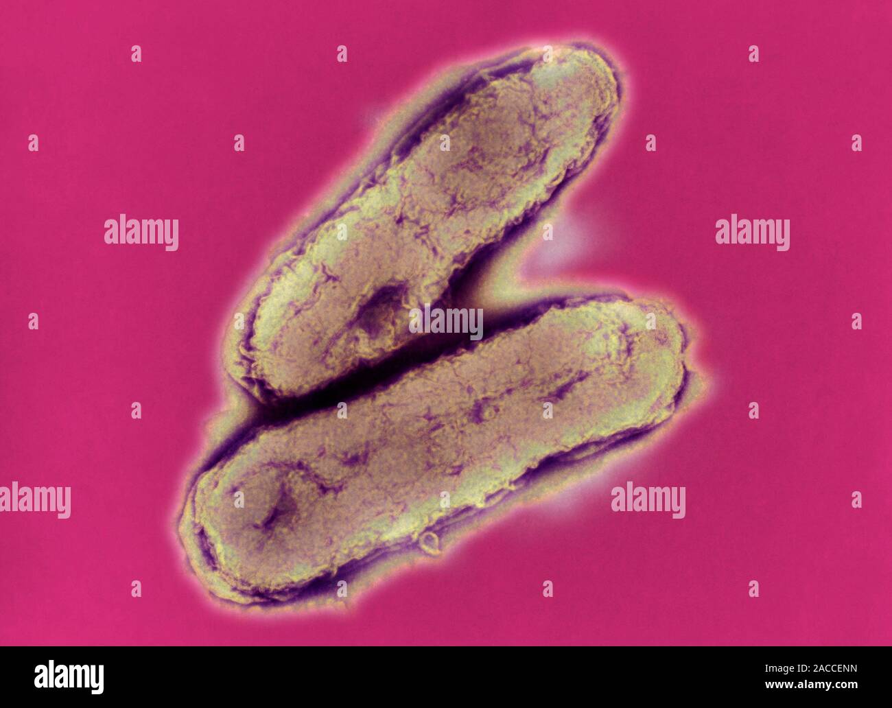 Haemophilus Influenzae Bacteria Coloured Transmission Electron Micrograph Tem Of Two