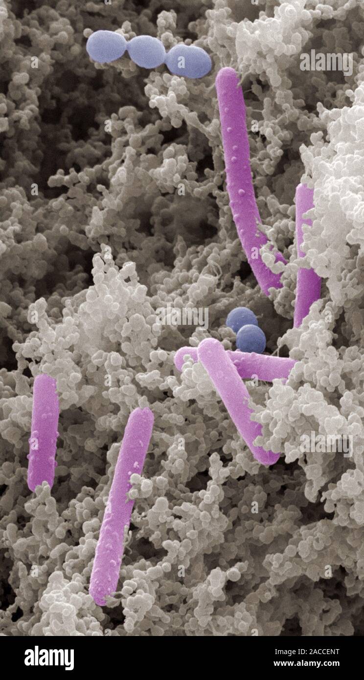 Yoghurt bacteria. Coloured scanning electron micrograph (SEM) of ... Yoghurt bacteria. Coloured scanning electron micrograph (SEM) of ...