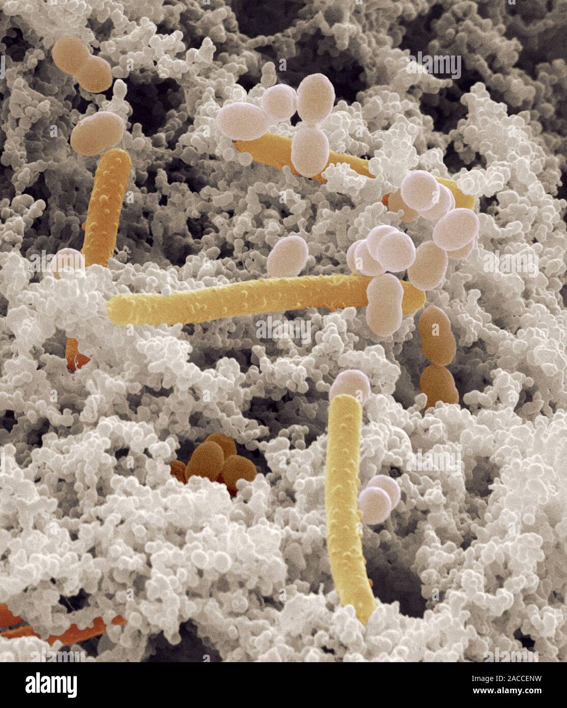 Yoghurt bacteria. Coloured scanning electron micrograph (SEM) of ... Yoghurt bacteria. Coloured scanning electron micrograph (SEM) of ...