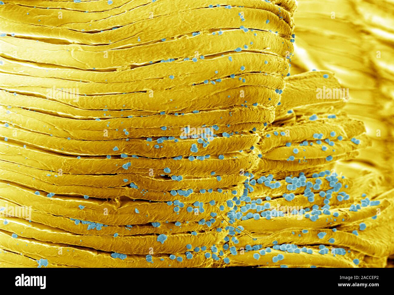 Deep sea bacteria (blue) on the surface (yellow) of annelid worms ...