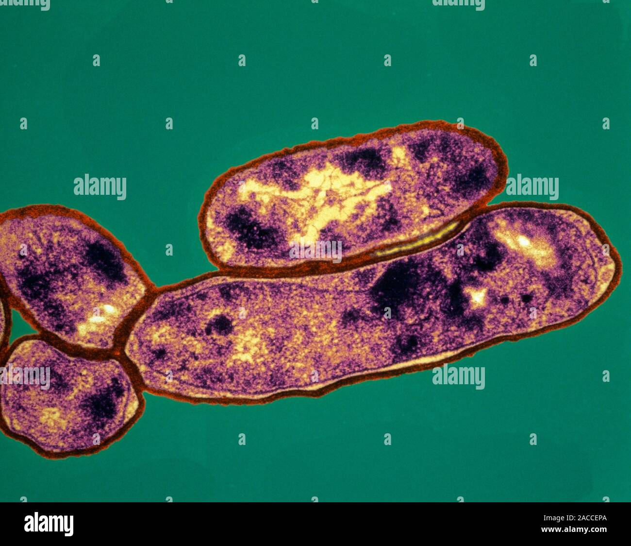 Diphtheria bacteria. Coloured transmission electron micrograph (TEM) of ...