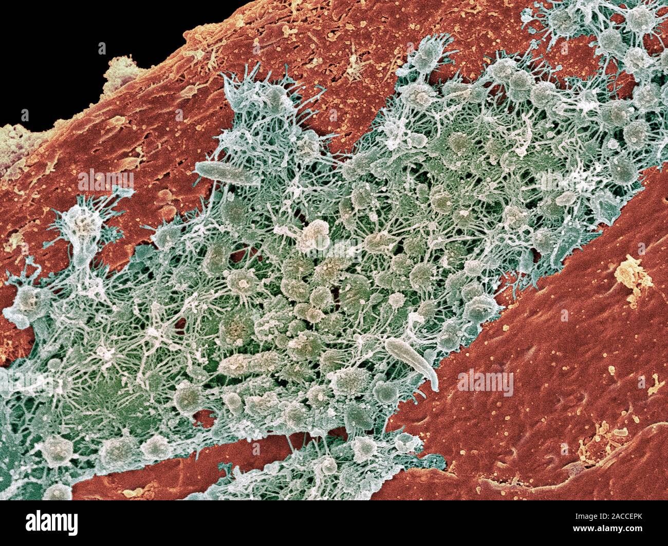 Tongue bacteria. Coloured scanning electron micrograph (SEM) of ...