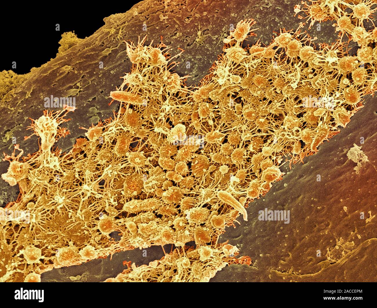 Tongue bacteria. Coloured scanning electron micrograph (SEM) of ...