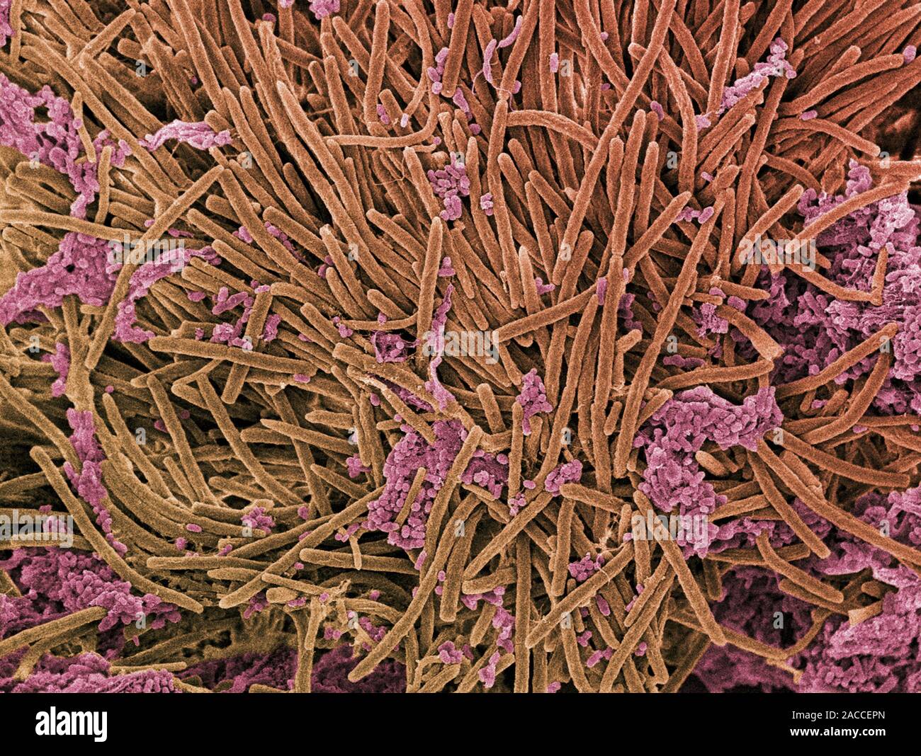 Tongue bacteria. Coloured scanning electron micrograph (SEM) of ...