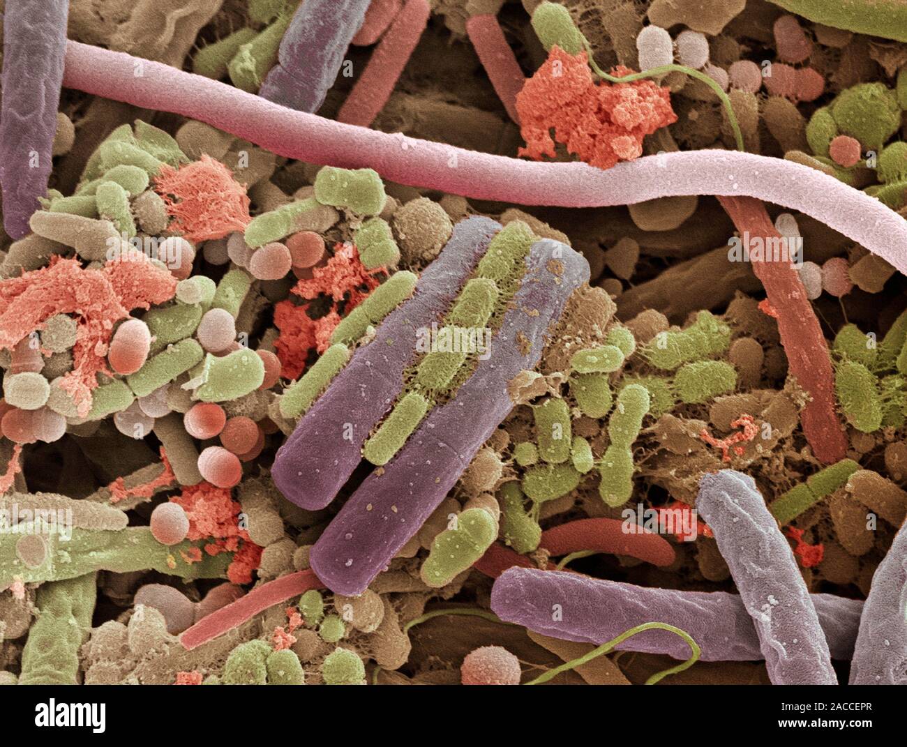 Tongue bacteria. Coloured scanning electron micrograph (SEM) of ...