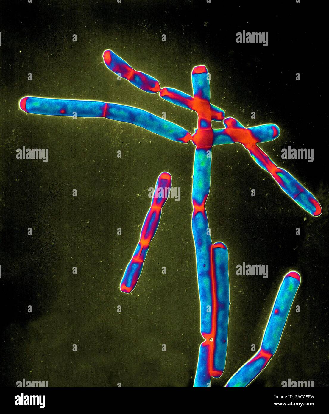 Anthrax bacteria. Coloured transmission electron micrograph (TEM) of ...