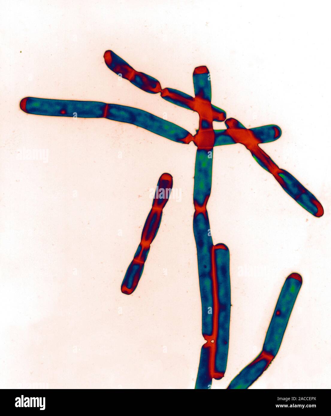 Anthrax bacteria. Coloured transmission electron micrograph (TEM) of ...