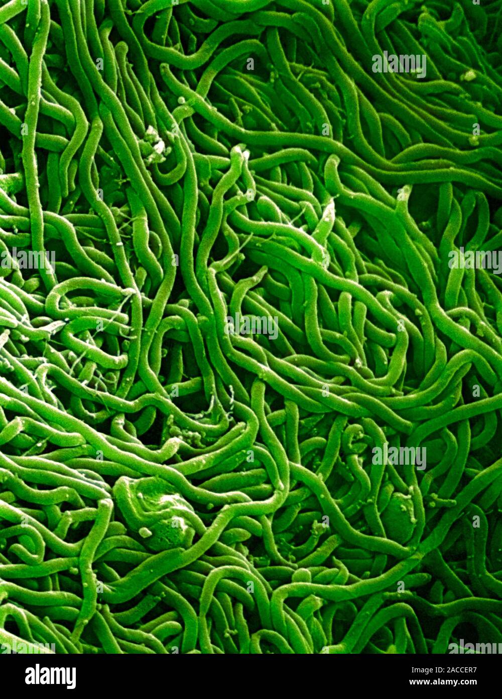 Borrelia bacteria, coloured scanning electron micrograph (SEM). These ...